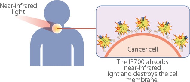 Cancer Photoimmunotherapy Research : Shimadzu Advanced Healthcare ...