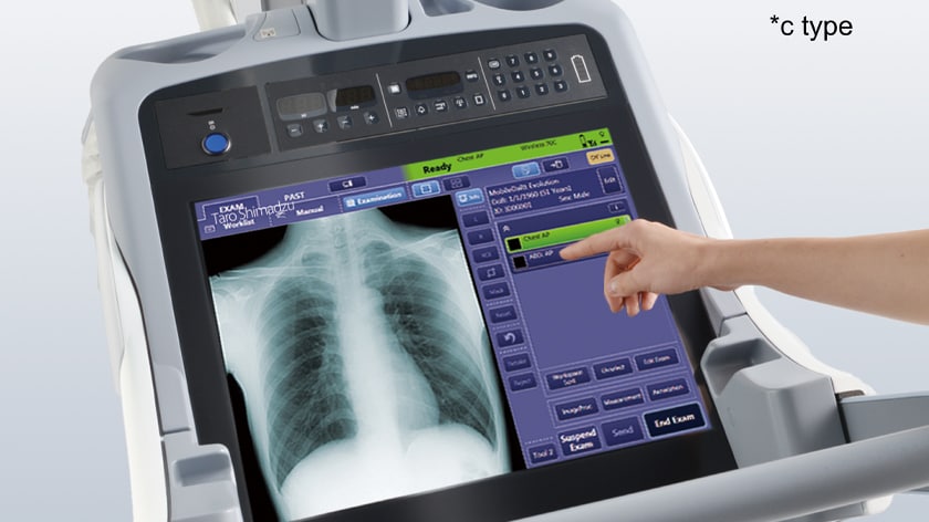 Digital Radiographic Mobile X-ray System - MobileDaRt Evolution MX8 ...