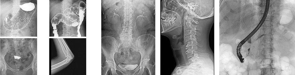 FLUOROspeed X1 edition : SHIMADZU CORPORATION