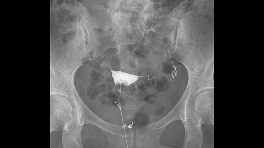 Patient-side R/F System - FLUOROspeed X1 edition | Shimadzu Medical ...