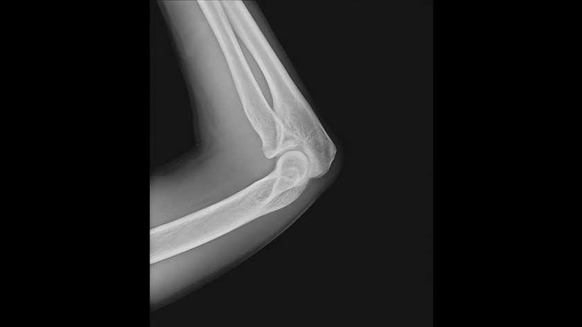 Patient-side R/F System - FLUOROspeed X1 edition | Shimadzu Medical ...