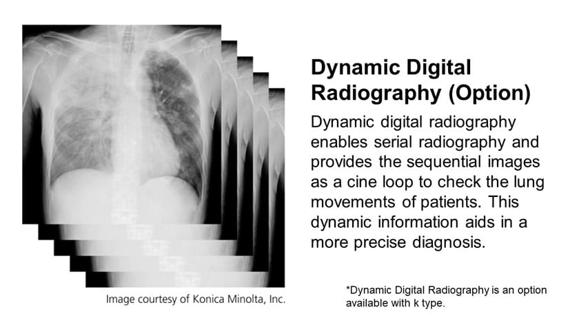 Digital Radiographic Mobile X-ray System - MobileDaRt Evolution MX8 ...